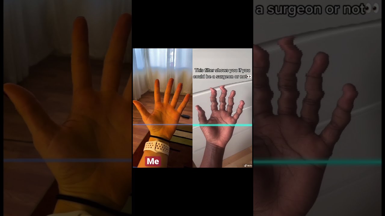 Real Doctor Tries Viral Tiktok Surgeon Challenge Youtube