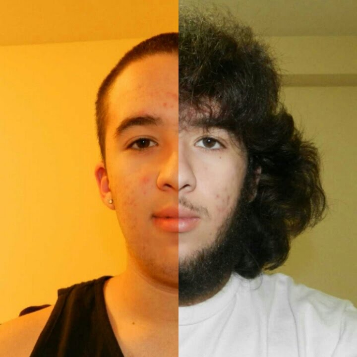 1 Year Hair Growth Time Lapse Youtube