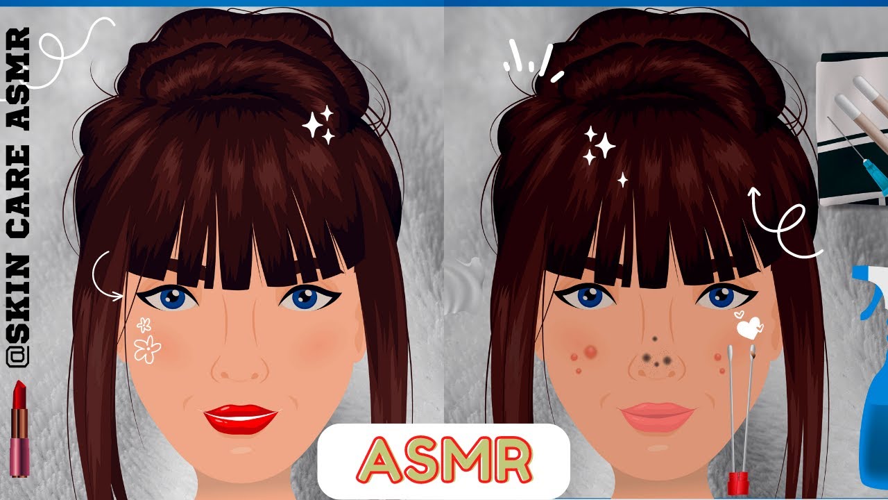 Asmr Skin Pimple Treatment Animation Acne Removal Youtube
