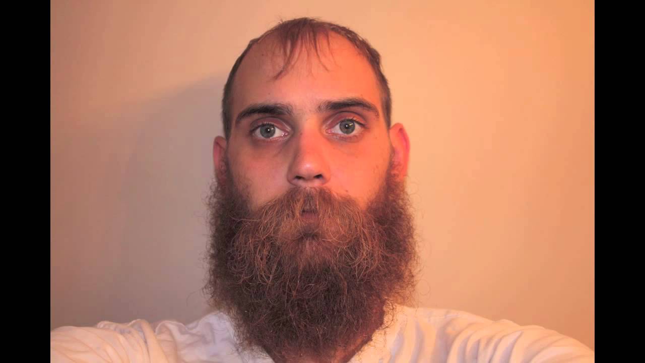 One Year Beard Growth Youtube