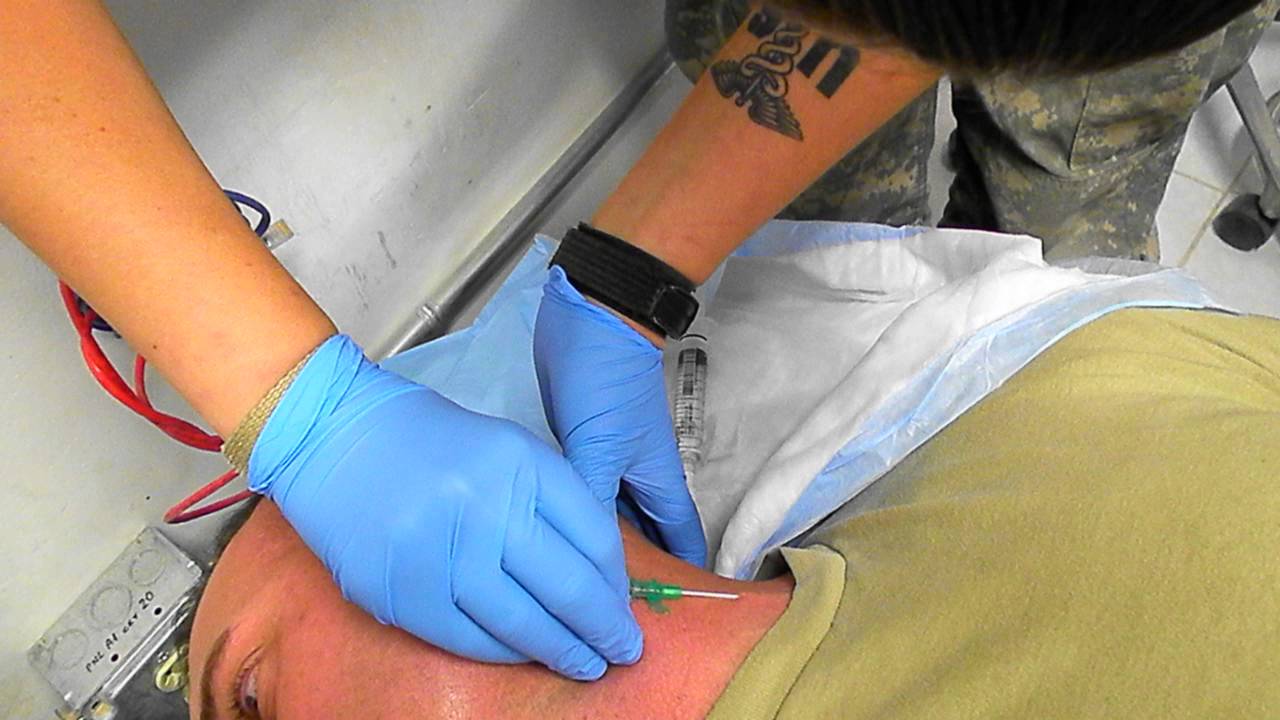 External Jugular Vein Cannulation