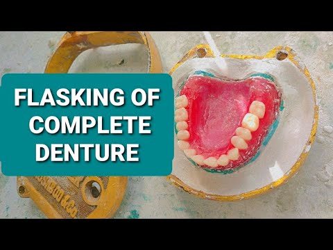 Flasking Of Complete Denture Youtube