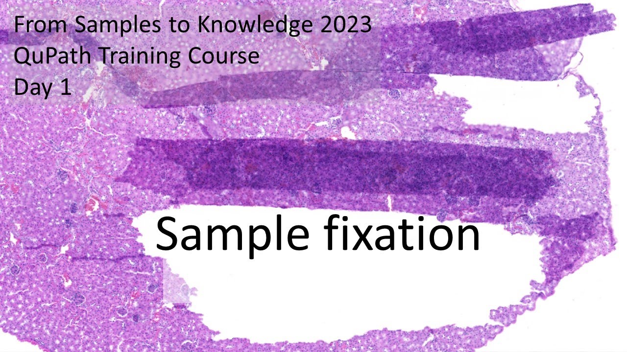 Sample Fixation Youtube