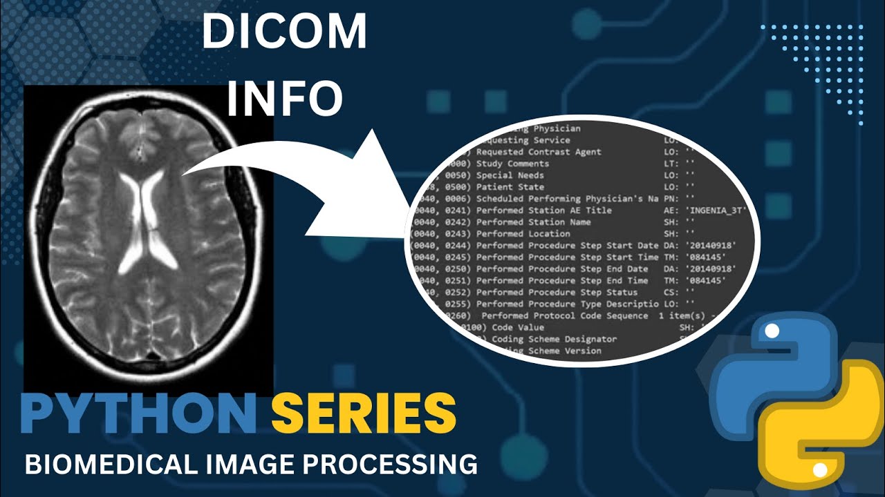 Dicom Info In Python Biomedical Image Processing Youtube