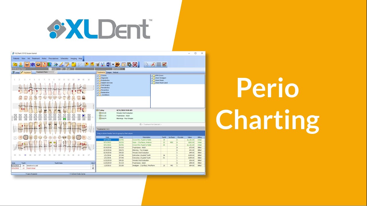 Xldent Dental Software Demo Perio Charting Youtube
