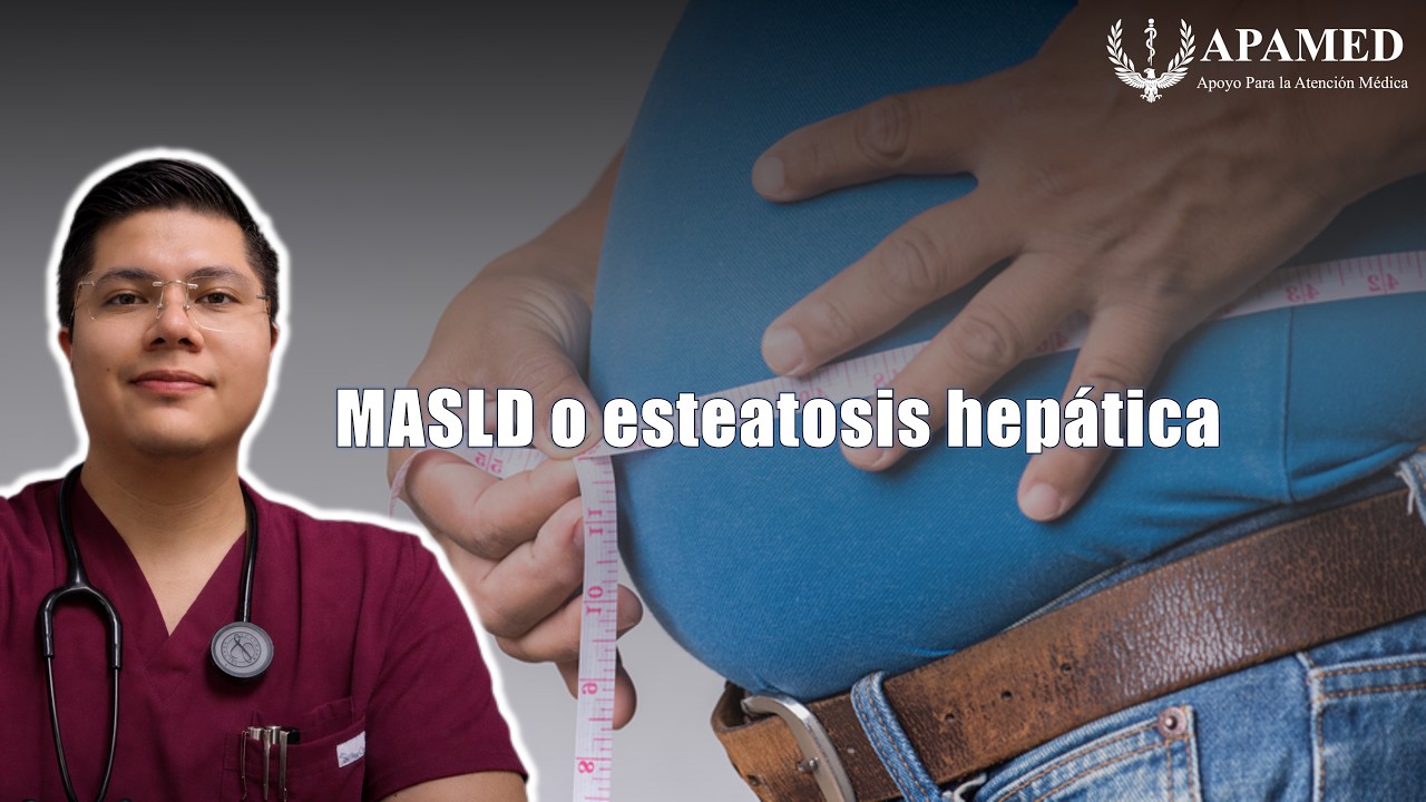 Esteatosis Hepática Asociada A Disfunción Metabólica Masld Nafld
