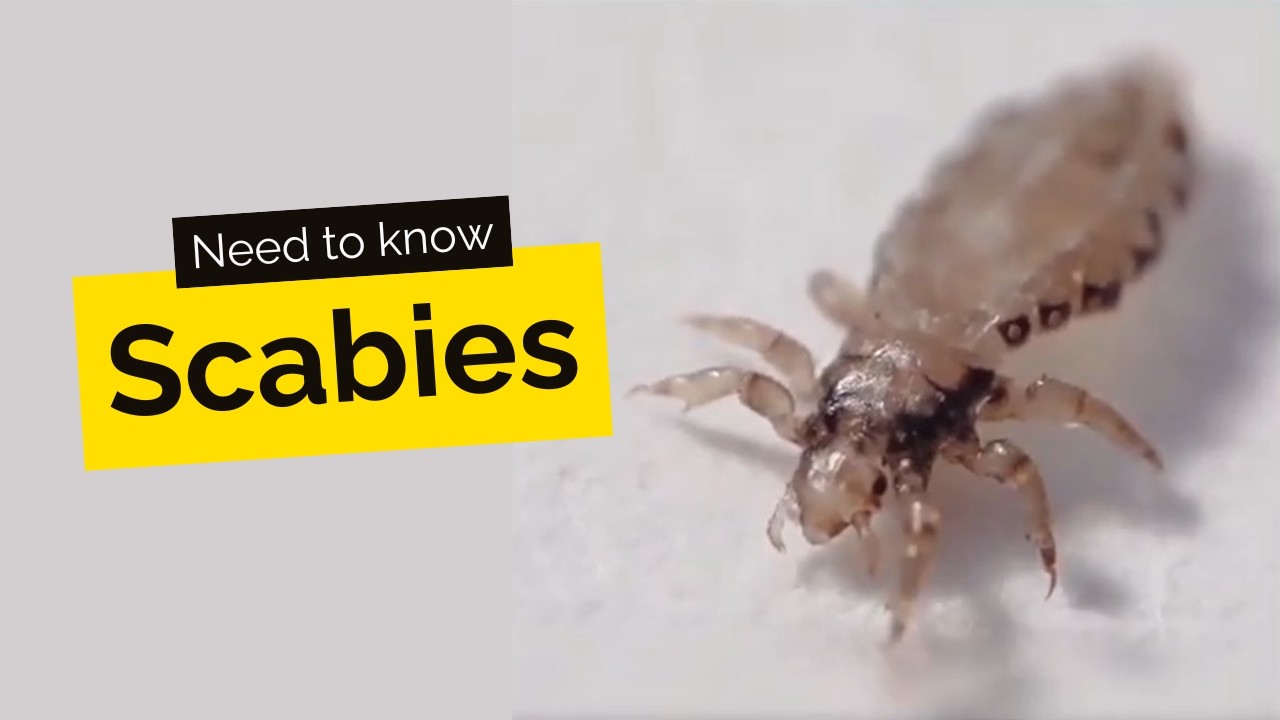 Scabies Bug Pictures