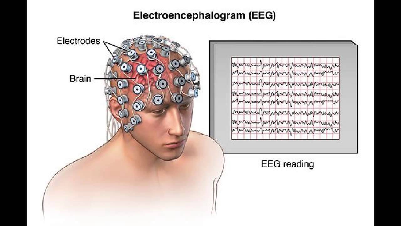 Neurofeedback Youtube