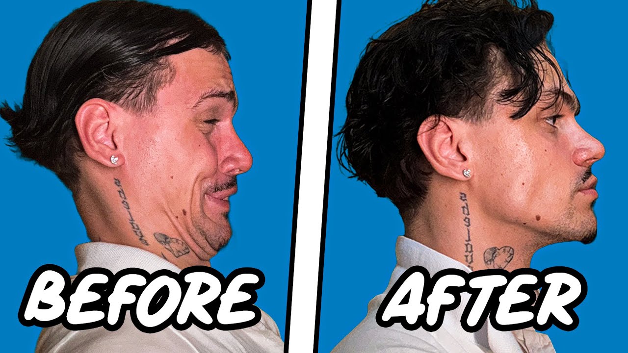 Mewing And Skincare Tutorial Youtube