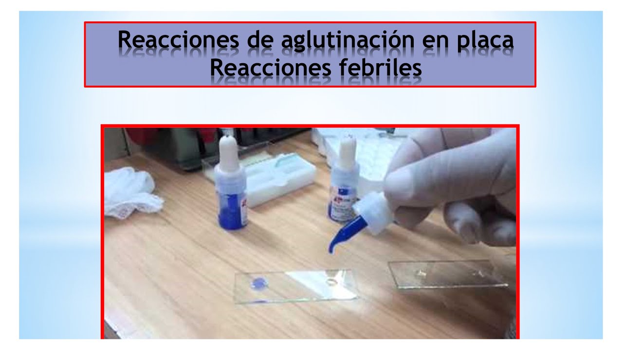 Clase 6 Reacciones Febriles Youtube