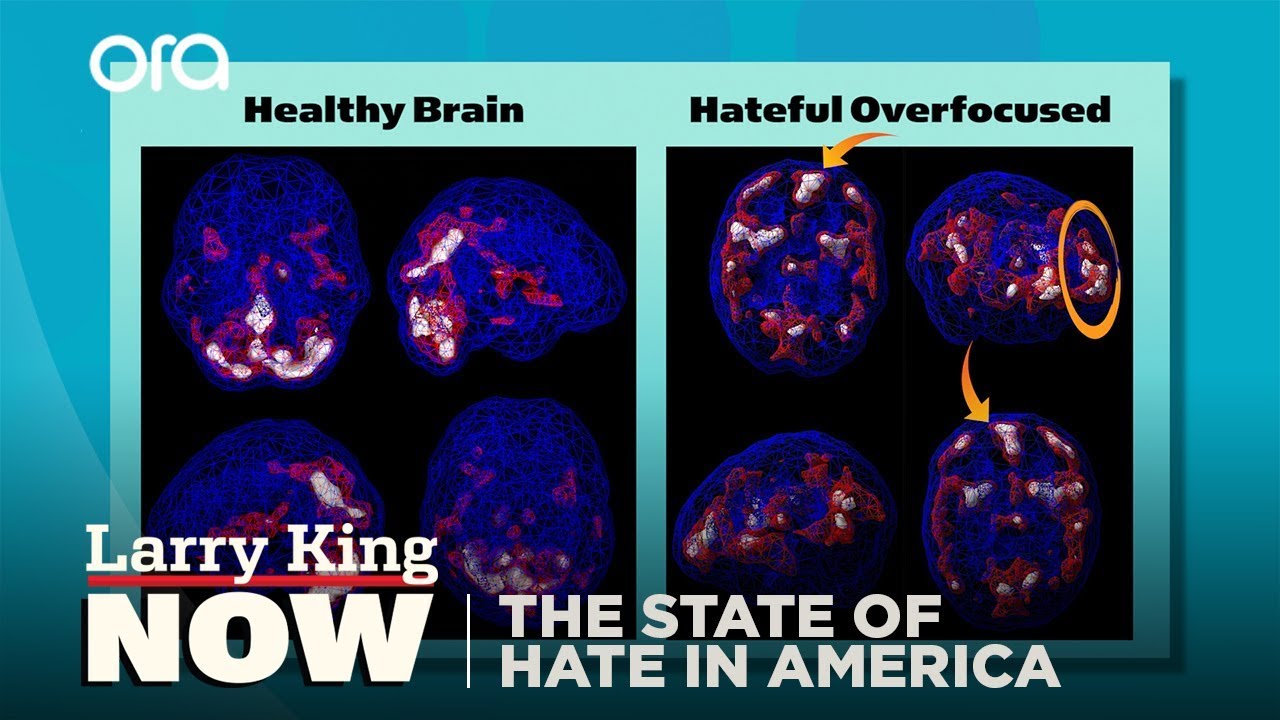 Inside The Brain On Hate Youtube
