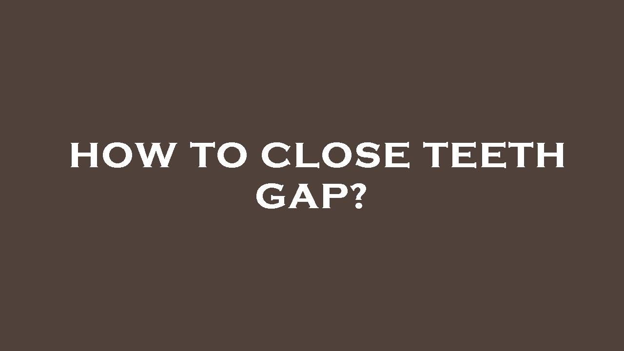 How To Close Teeth Gap Youtube