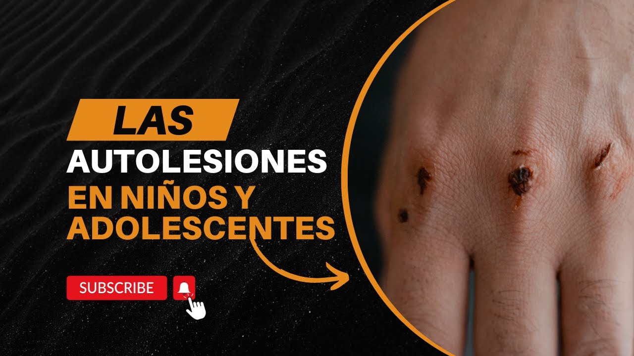 Las Autolesiones En Niños Y Adolescentes Youtube
