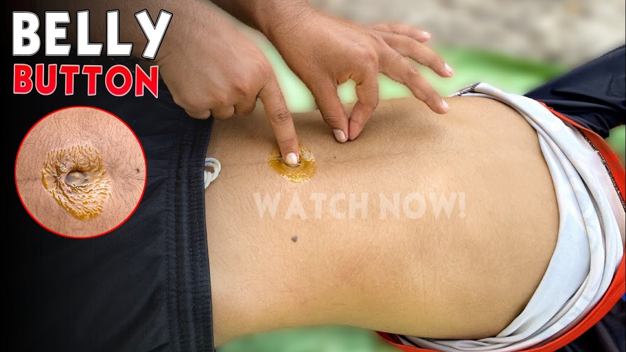 Asmr Belly Button Massage That Will Give You Extreme Sleep In