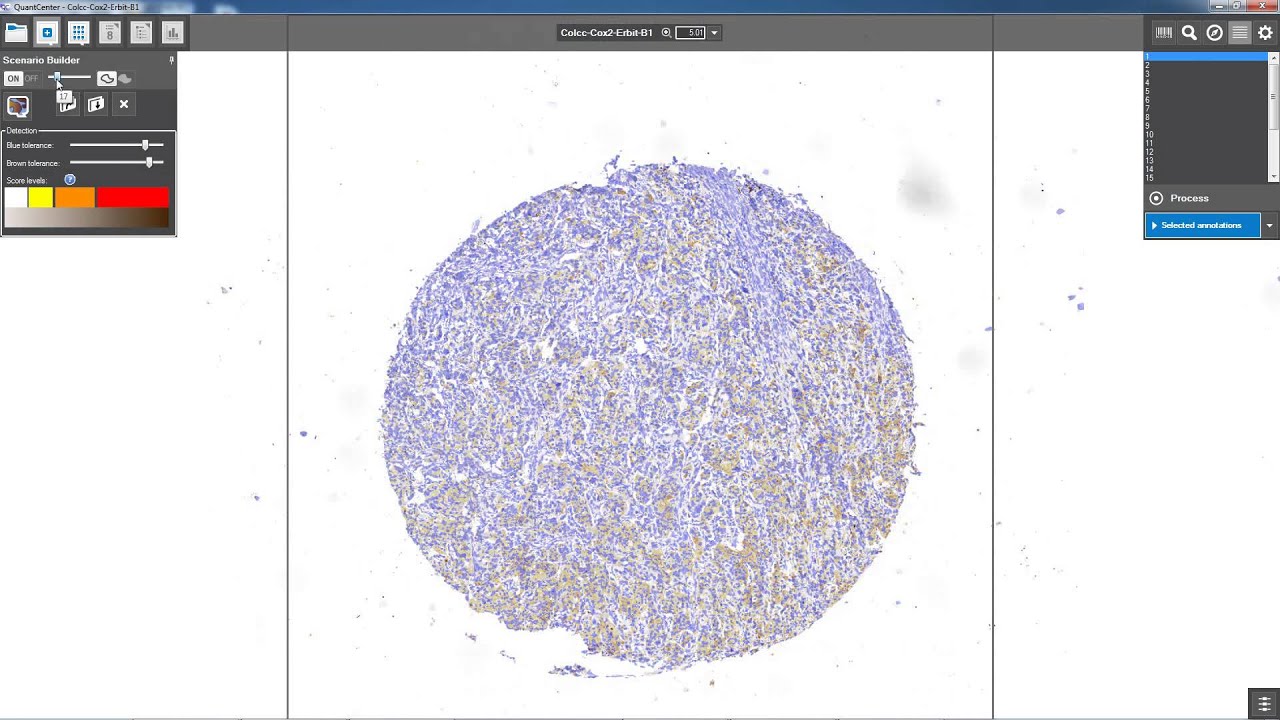 3dhistech Densitoquant Youtube