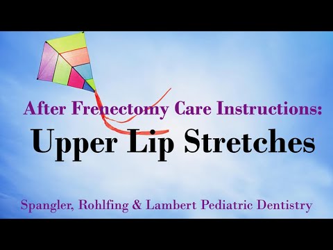 After Frenectomy Care Instructions Upper Lip Stretch Youtube