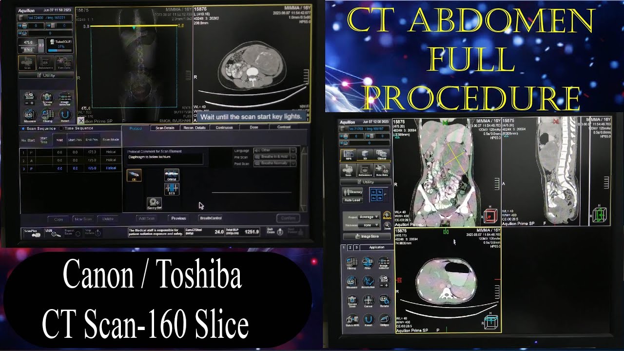 Ct Scan Of Abdomen Full Procedure Basicradiology Youtube