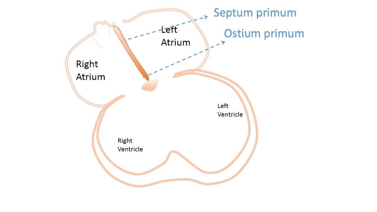 Interventricular Septum Development