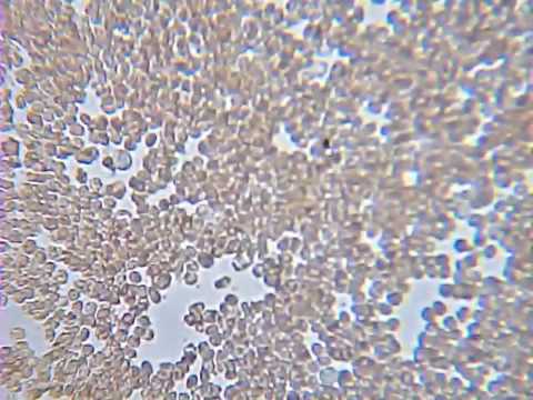 Gota De Sangre Microscopio Glóbulos Rojos Y Blancos 640x Hematies Y
