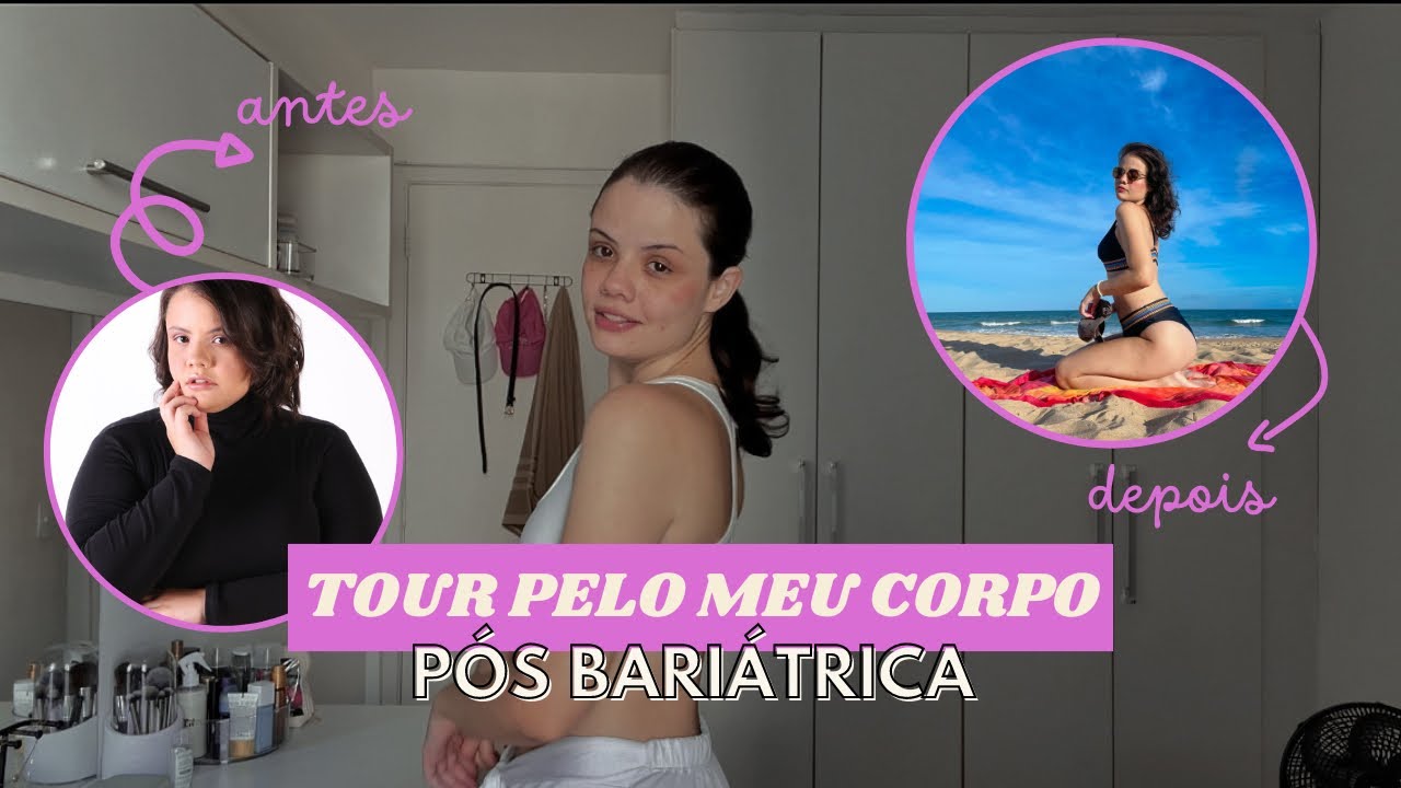 Tour Pelo Meu Corpo Pós Cirurgia Bariátrica Flacidez Autoestima