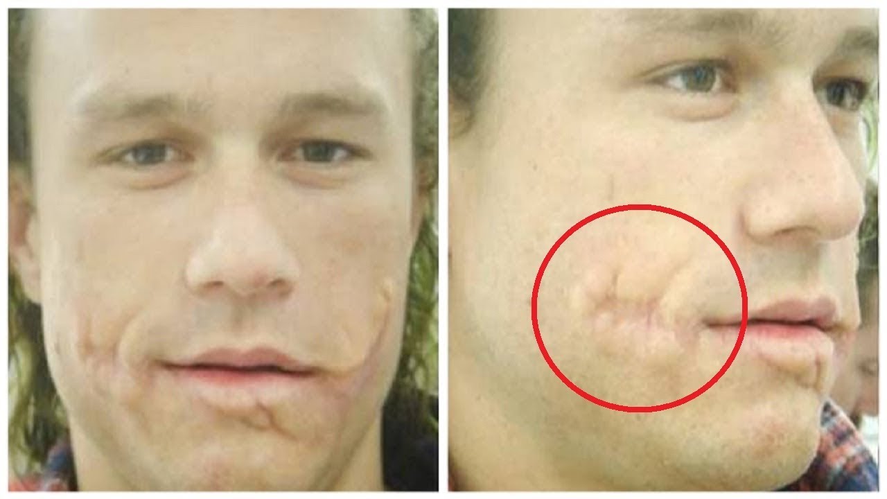 Heath Ledger Scars Without Makeup Scarface Warpaintmag