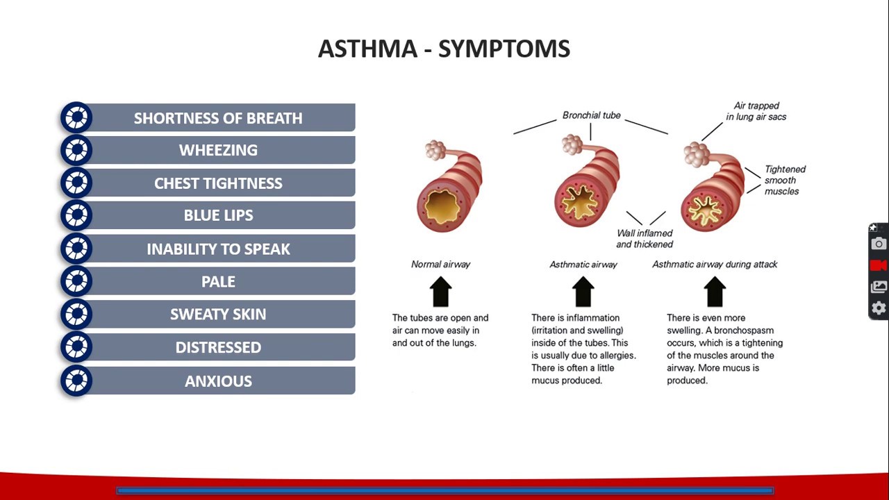 Asthma Presentation Youtube