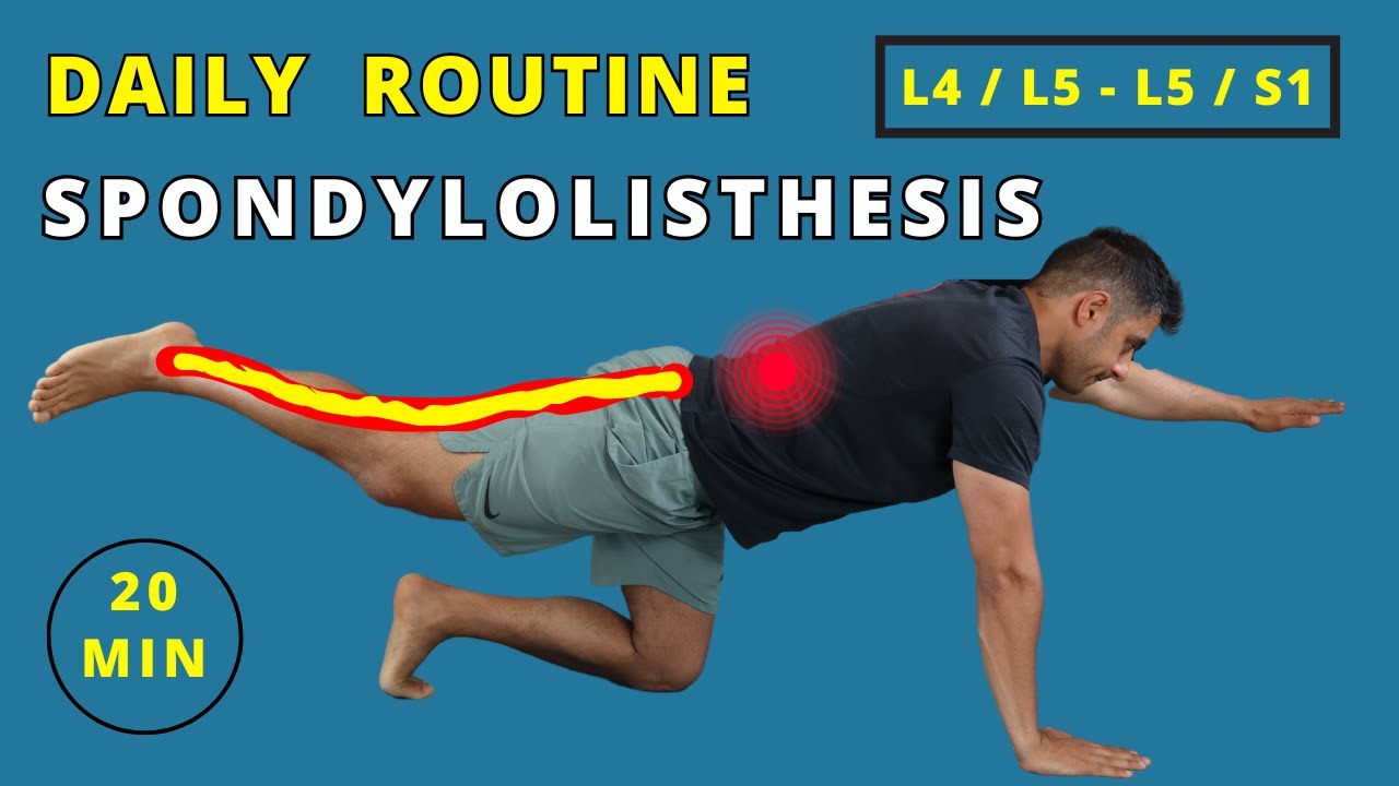 Daily Workout Routine For Spondylolisthesis Youtube