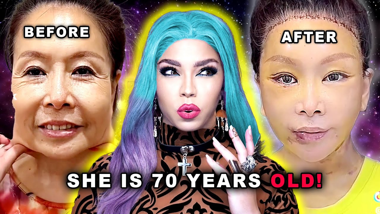 Tiktok S Unhinged Plastic Surgeon Is Out Of Control Dr Kim Cyber