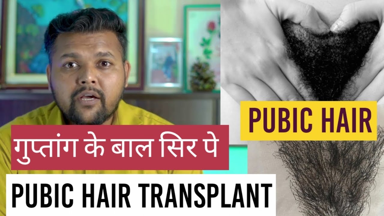 ग प त ग क ब ल स ट र सप ल ट Pubic Hairs For Hair Transplant