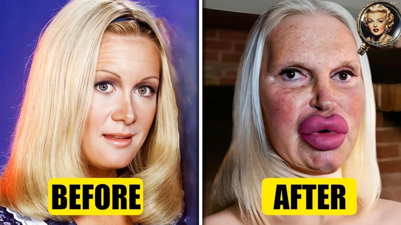 25 Famous Celebrities Who Ruined Their Faces With Plastic Surgery Youtube