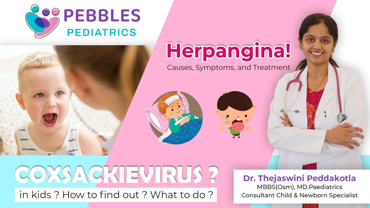 Herpangina In Kids Symptoms Causes And Treatment Pediatrician S
