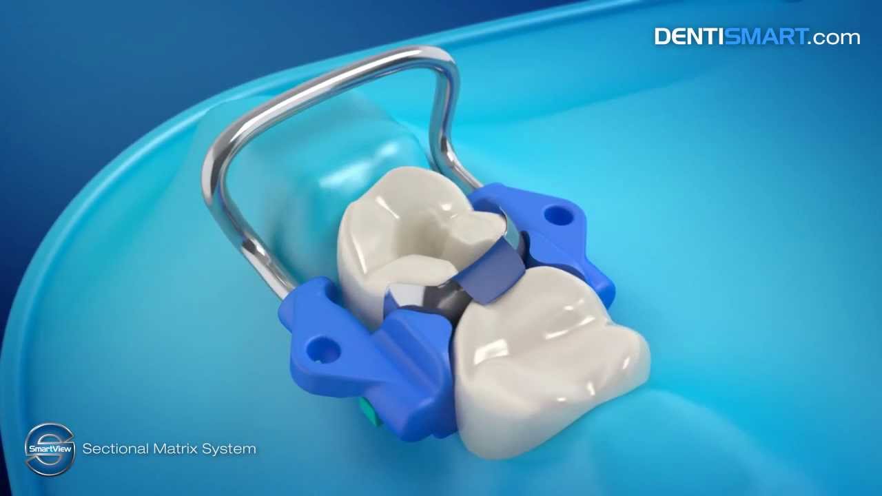 Smartview Sectional Matrix System Product Video Youtube