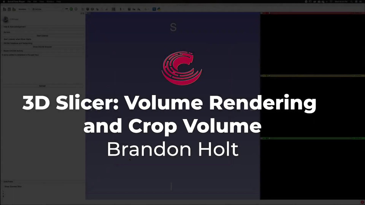 3d Slicer Volume Rendering And Crop Volume Youtube