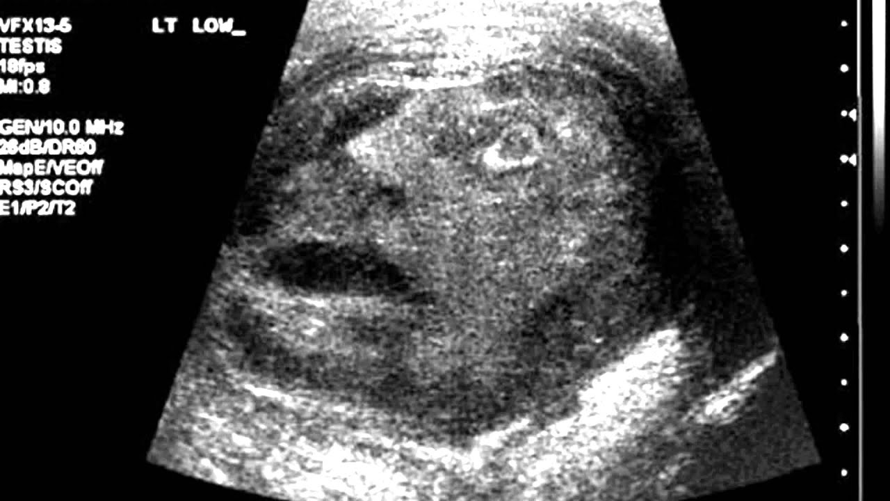Strange Face Appears In A Ultrasound Scan Youtube