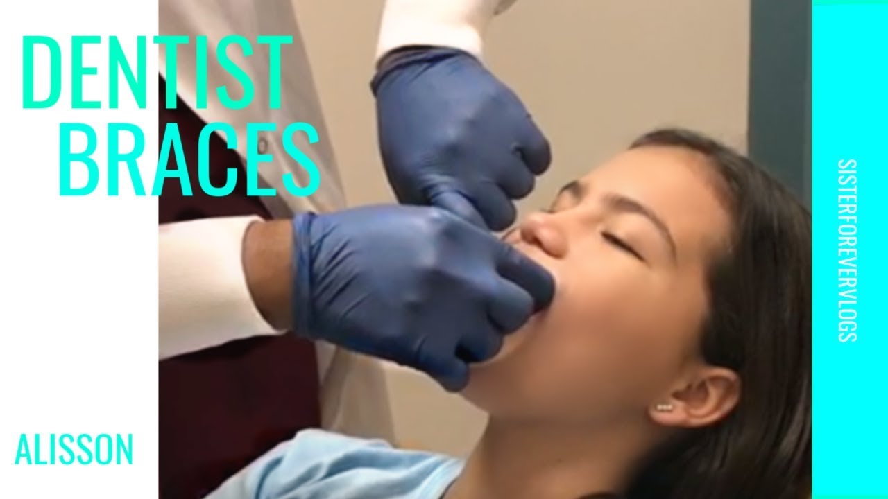 Orthodontist Braces Appointment 349 Youtube