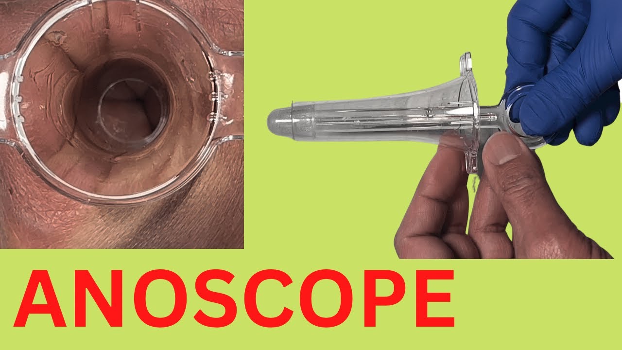 How Does An Anoscope Work Youtube