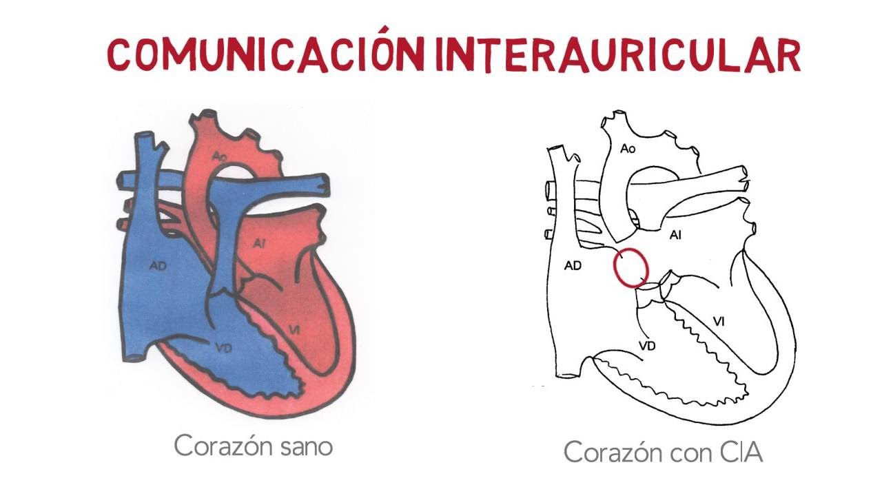 Cia Comunicación Interauricular Youtube