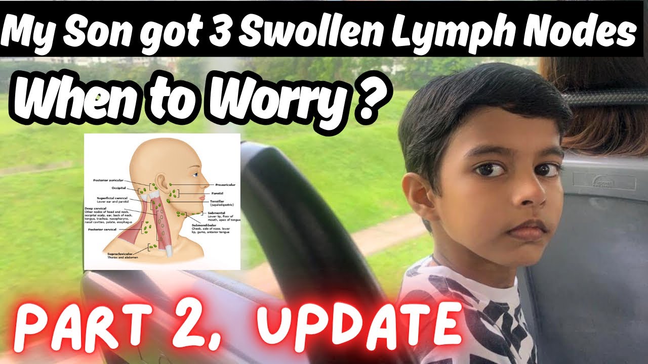 Lump Behind Ear Lymph Node Can Allergies Cause Swollen Lymph Nodes