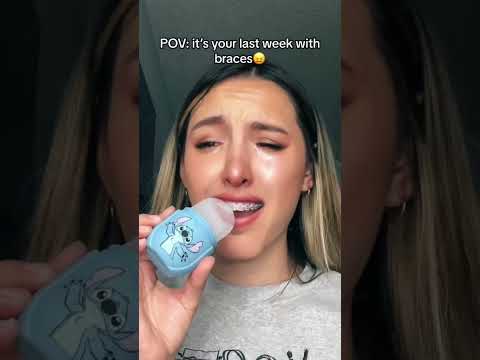 Why Did Ross Get Braces