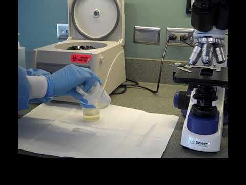 Preparing A Urine Specimen For Microscopic Examination Youtube