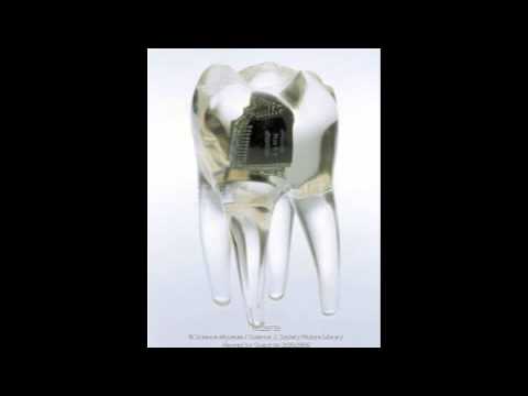 Hearing Voices Audio Implants Youtube