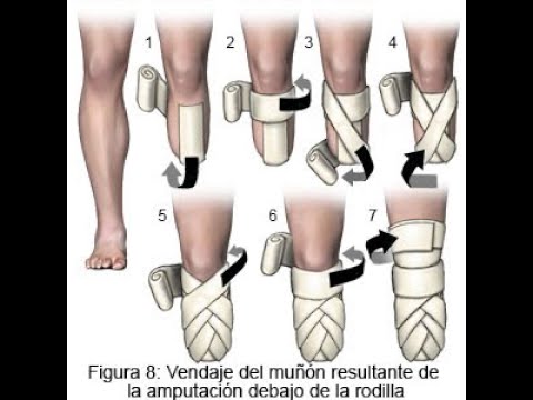 Vendaje Muñón Youtube