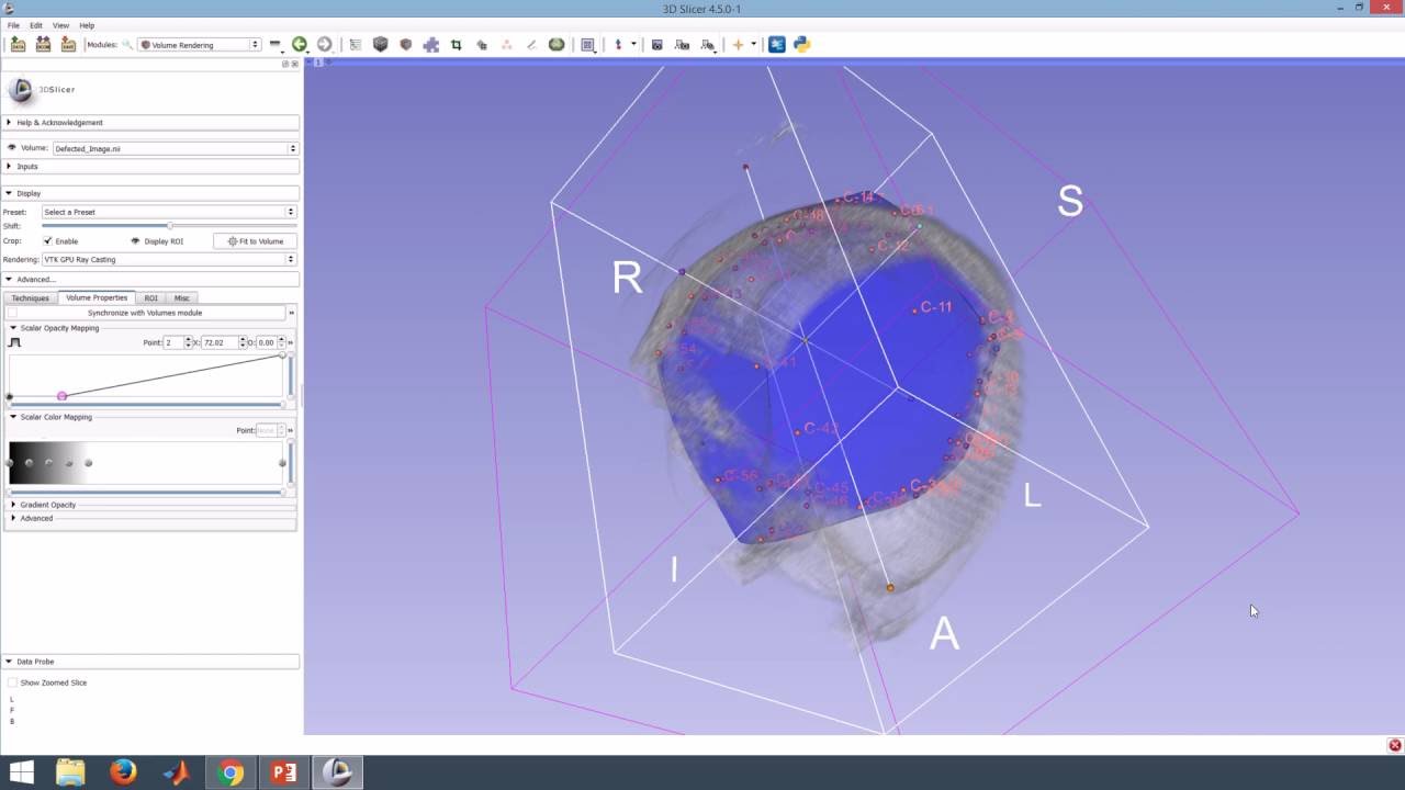 Volume Clipping Cropping With Model On Slicer 3d Youtube