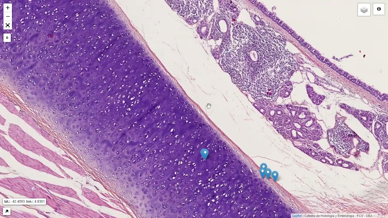 Histología De La Laringe