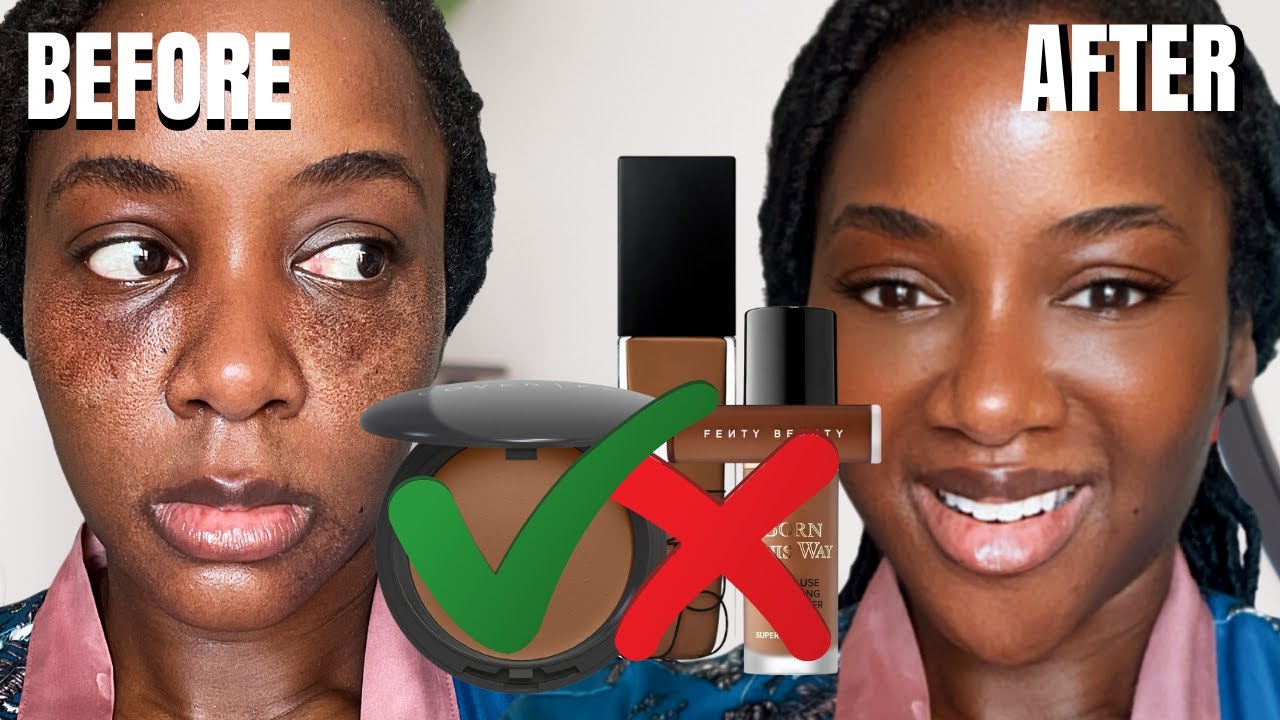 How To Cover Hyperpigmentation With Makeup On Dark Skin Instantly Youtube