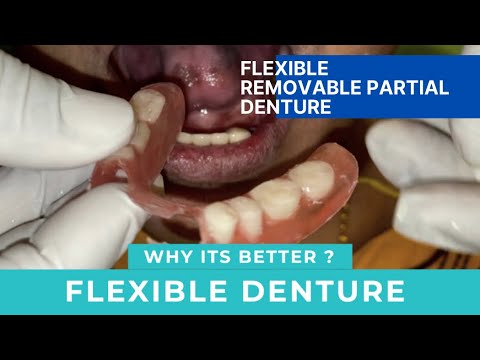 Flexible Partial Denture Details And Demo On Patient Youtube