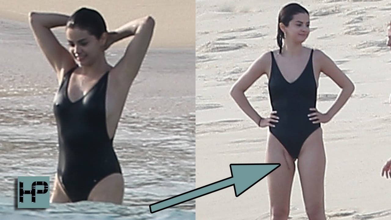 Selena Gomez Reveals Massive Scar On Her Thigh Youtube