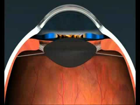 Accommodation Youtube