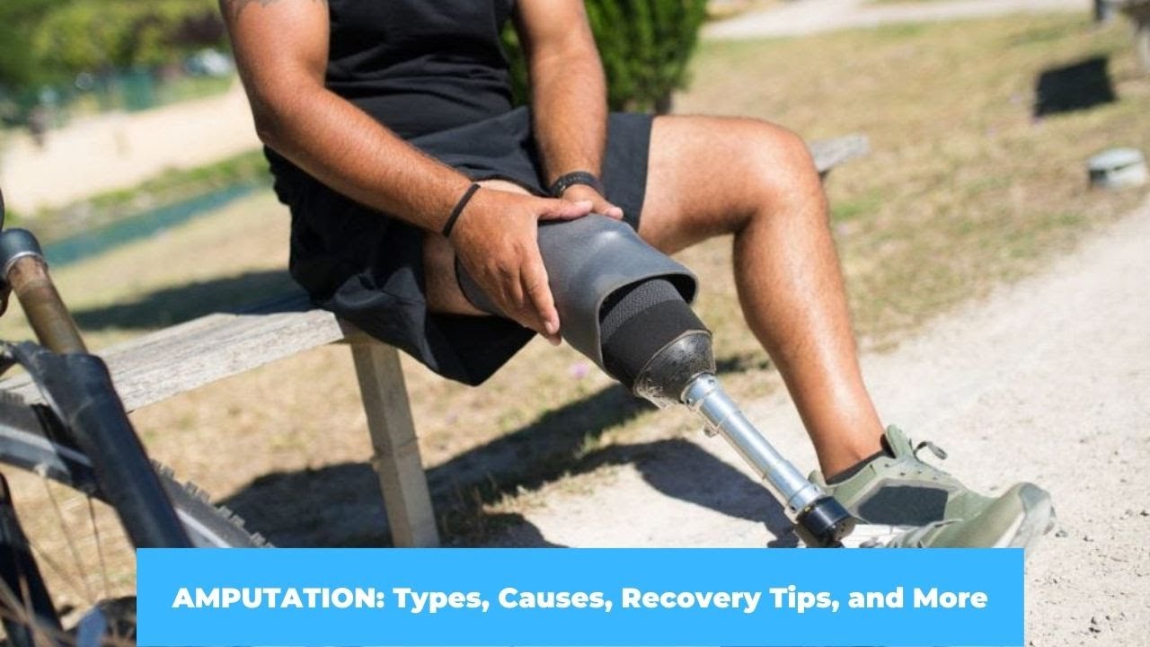 Amputation Types Causes Recovery Tips And More Youtube