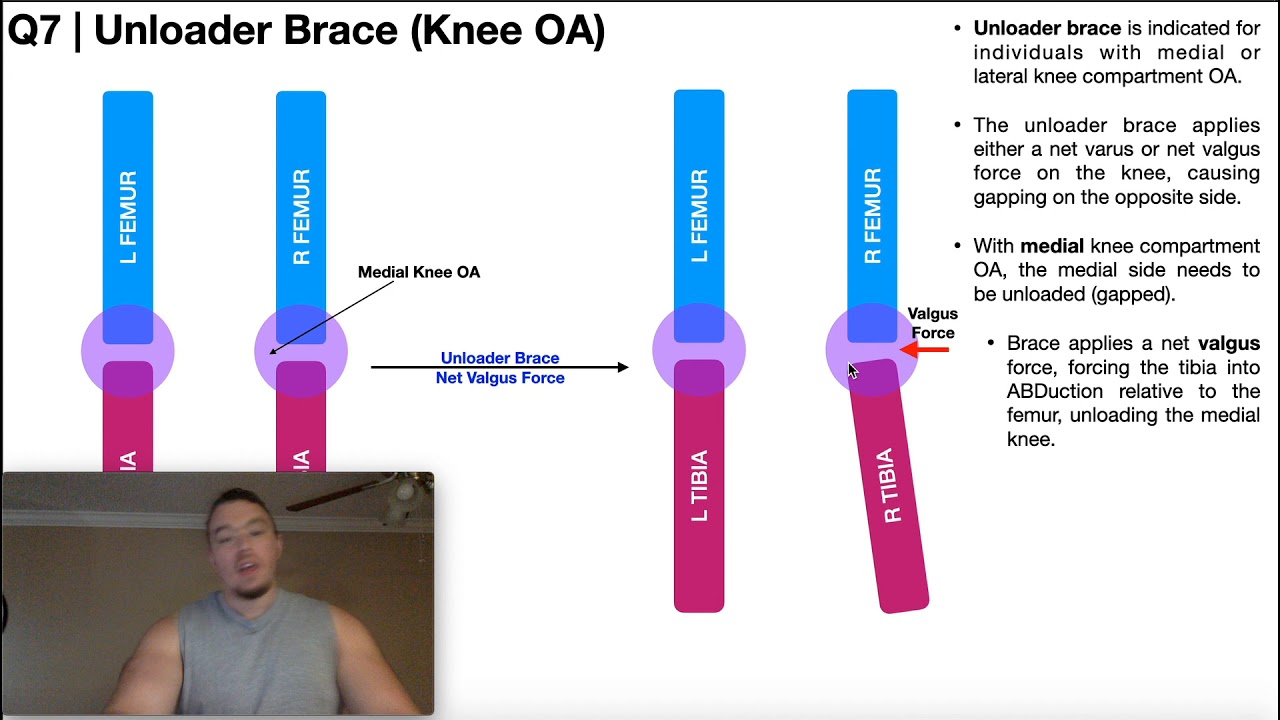 The Unloader Brace For Knee Oa How Does It Work Youtube